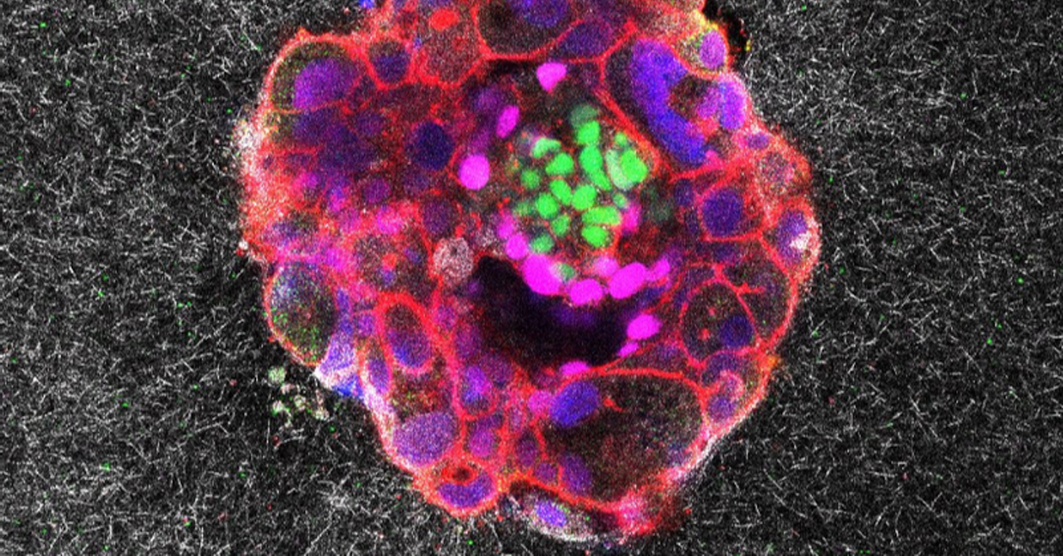 Gravate for the first time the implantation of a human embryo in the ...